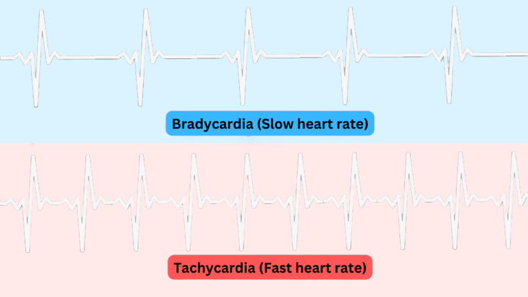 How To Measure Resting Heart Rate