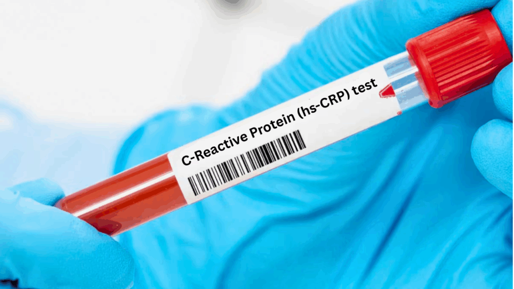 How To Measure Inflammation With A CRP Blood Test